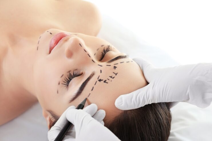 How Polydioxanone Thread Lift is Changing the Aesthetics Industry ...